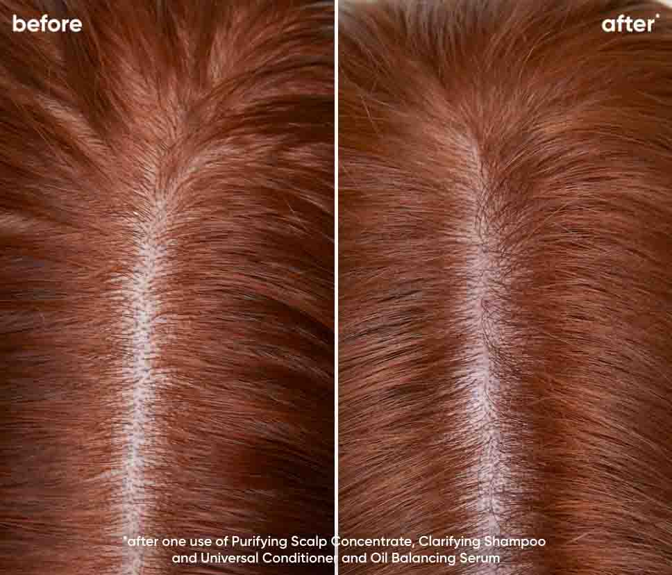 Matrix Biolage Scalp Sync Clarifying Shampoo 400ml – Beautopia Hair ...